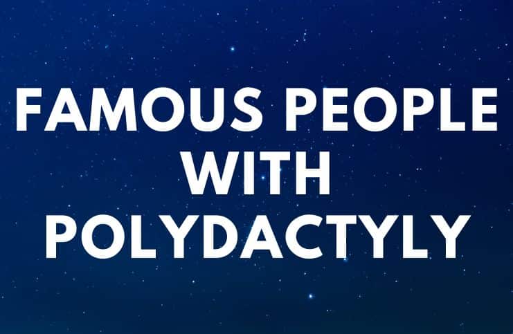 12 Famous People With Polydactyly (Halle Berry?) - Your Health Remedy
