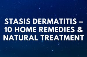 Stasis Dermatitis – 10 Home Remedies & Natural Treatment - Your Health ...