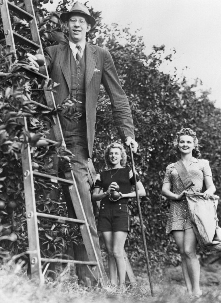 Famous People With Gigantism or Acromegaly - Your Health Remedy